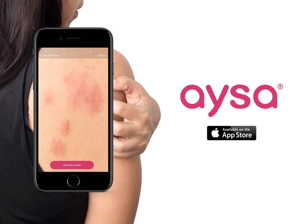 How Aysa, an AI App, Helped a Mother with her Child’s Rash | The People ...